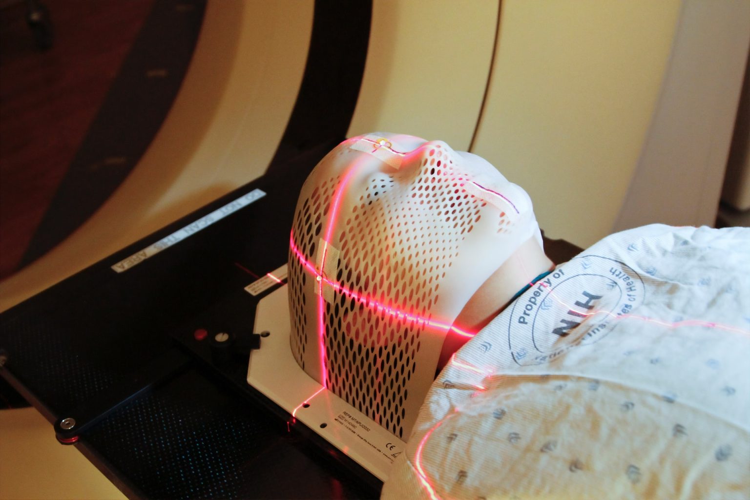 Hyperbaric Oxygen for Radiation-induced Injuries Provides Lasting ...
