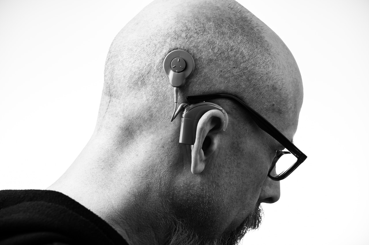 ‘It’s a great sign’: Innovative Cochlear Implant Trial Expands Earlier ...