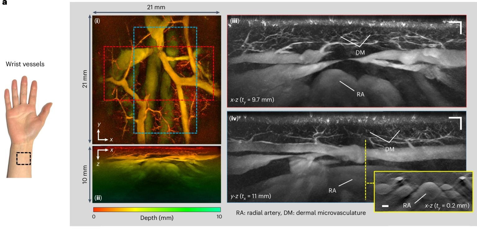 Hand-held Medical Scanner could Transform Cancer and Arthritis ...