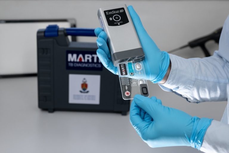 UP Researchers Innovate Handheld Detection Device that Could Transform ...
