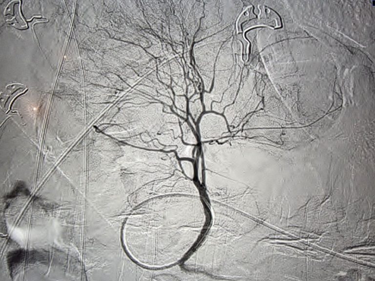 Beyond Diagnosis: The Treatment Power of Modern Radiology - Quicknews